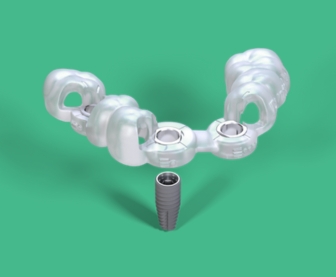 Straumann Guided Surgery - اشترومن